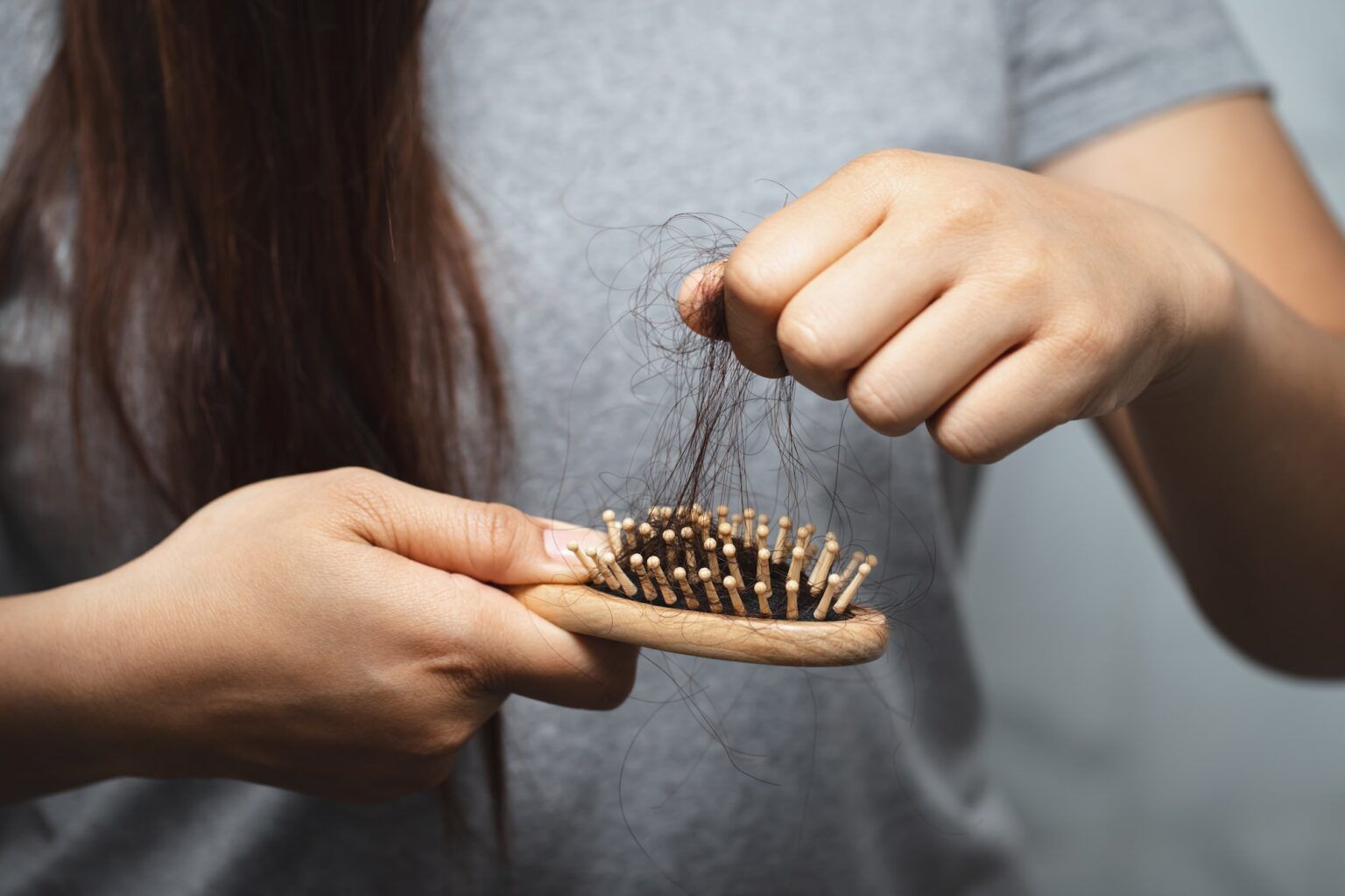 Women’s Hair Loss and Hair Restoration in New Mumbai - Dermaplast ...